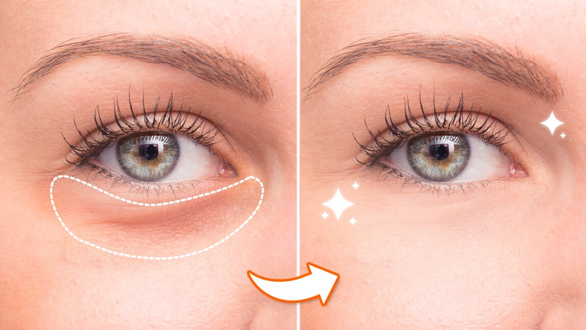 How To Remove Eye Bags From Photos With A Free App PERFECT